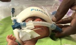 Pumani bCPAP Training Films | Picturing Health